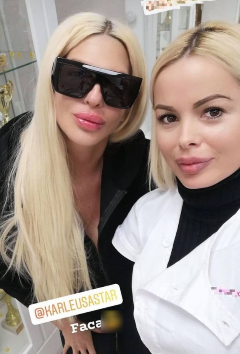 RUSKE USNE: Jelena Kareluša zabilježila estetski zahvat